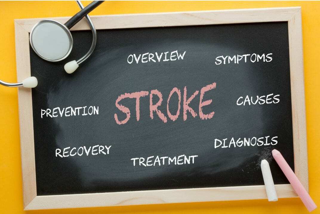 Guide to Stroke Recovery: Rehabilitation and Post-Stroke Recovery